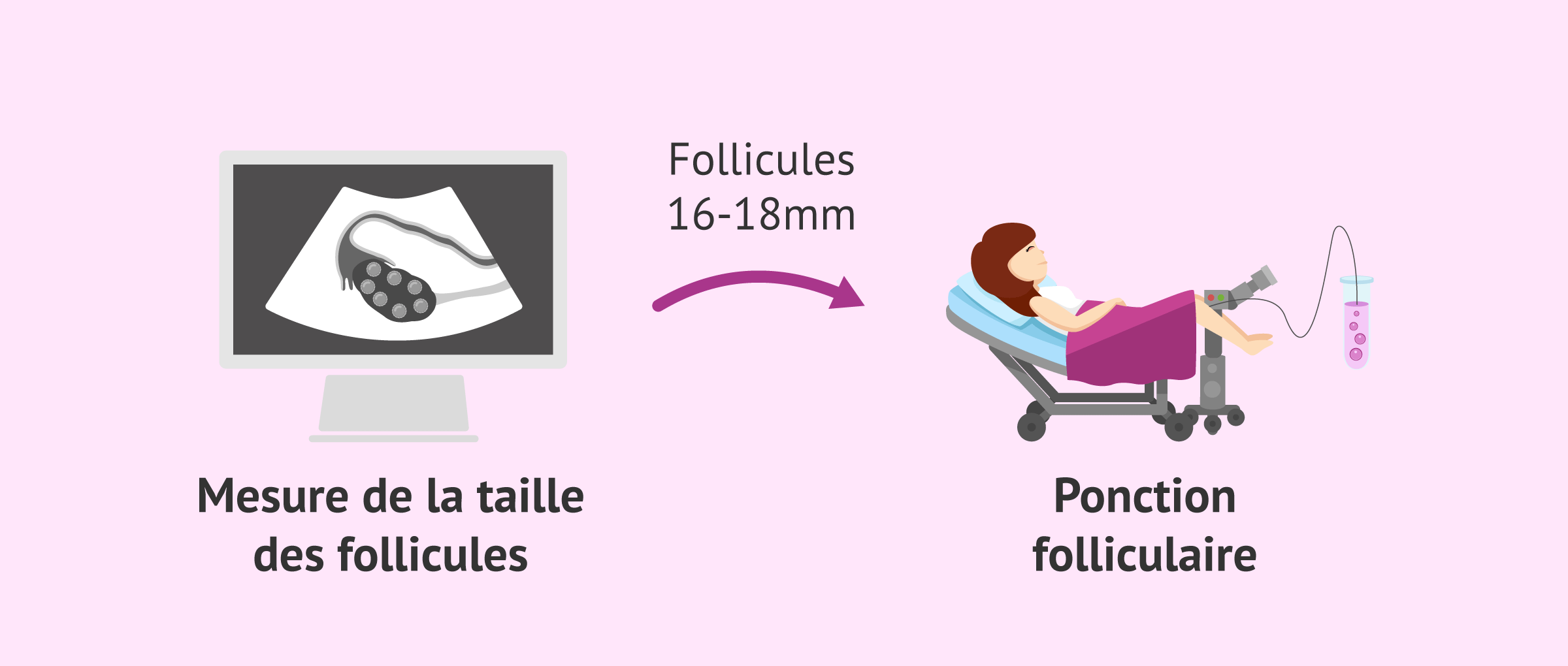 Déroulement d'une FIV: quelles sont les étapes du traitement?