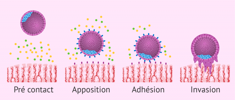 Nidation ou règles? - Symptômes de l'implantation réussie de l'embryon
