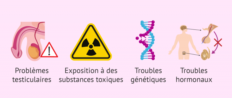 Azoospermie sécrétoire et obstructive: causes et diagnostic